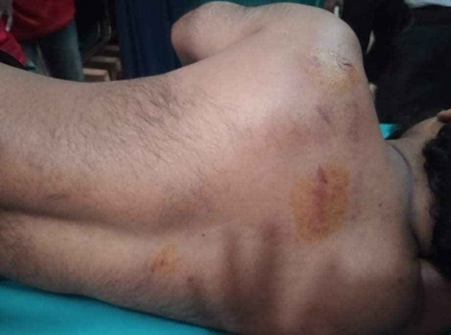 কালকিনি কয়ারিয়া ইউনিয়নে নির্বাচনী পরবর্তী সহিংসতা - Amader Orjon